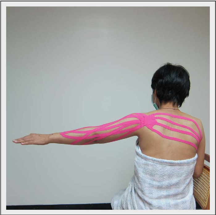 Kinesio Taping & Lymphedema ⋆ Sunnybrae Therapeutics